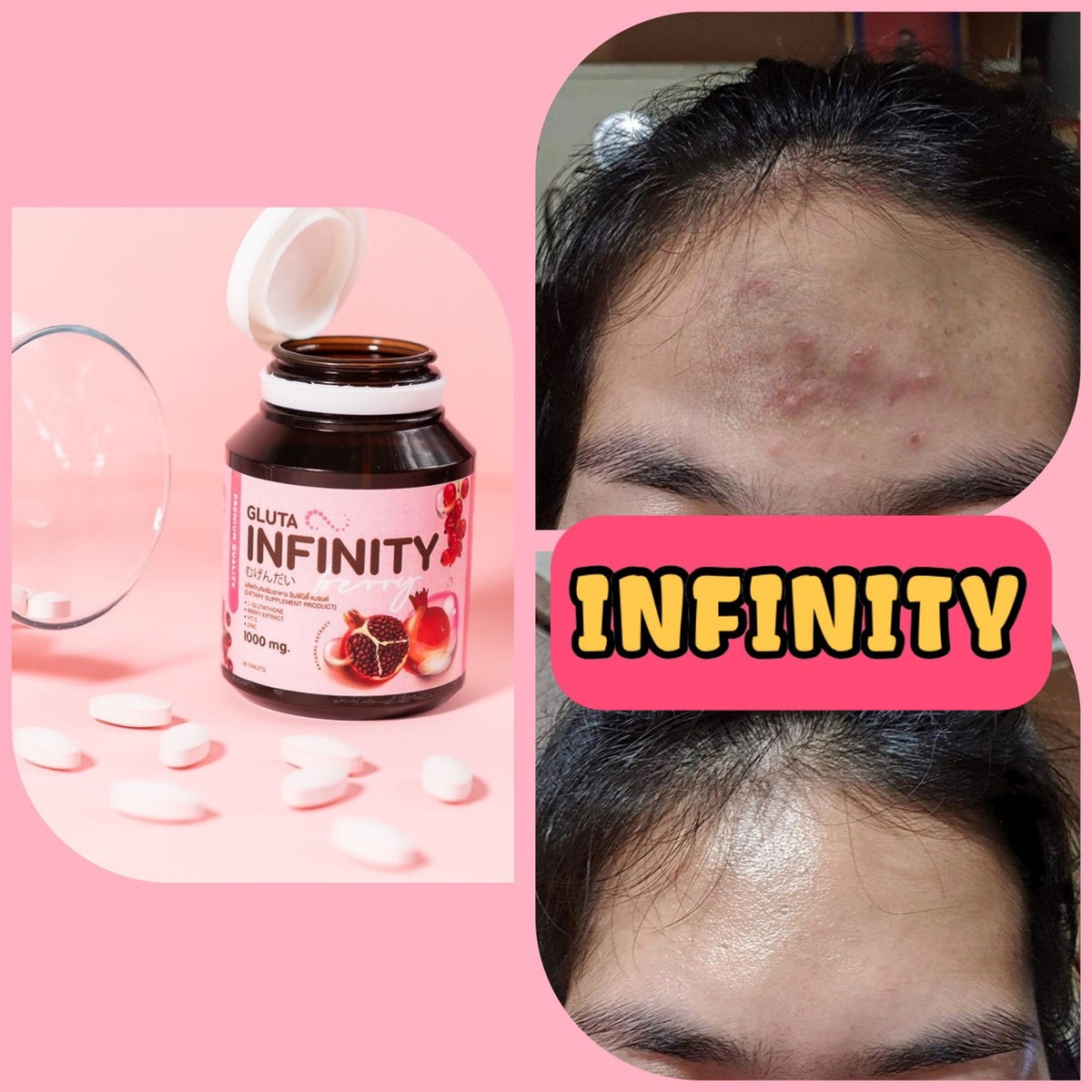 Gluta Infinity 30 Tablets – Luxe Queen